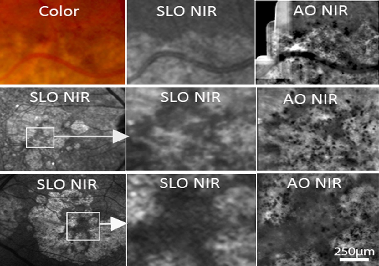 Formation High resolution imaging for ophtalmology: adaptive optics and ...